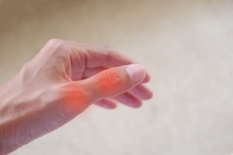 Thumb Arthritis: Causes, Relief, Prolotherapy & Expert Advice