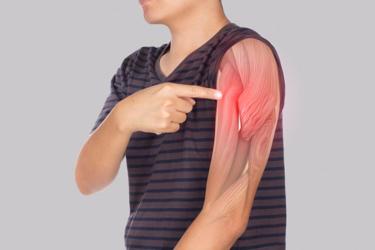 Understanding the Deltoid Ligament: Essential Guide to Recovery