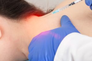 How an Occipital Nerve Block Can Ease Chronic Headaches
