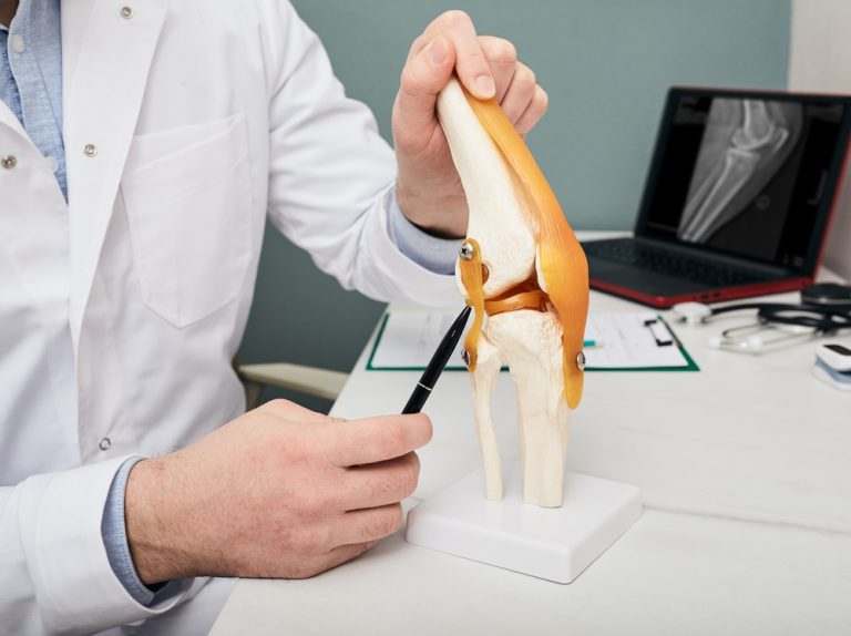 Knee Sprain Recovery Time: Tips for Effective Healing