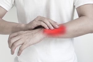 Wrist Bursitis: Causes, Symptoms & Treatments