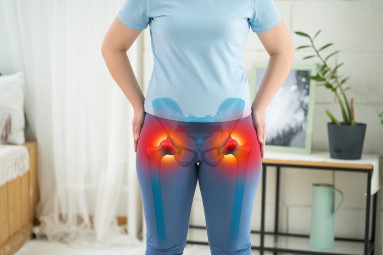 Top 6 Hip Labral Tear Exercises to Improve Mobility & Reduce Pain