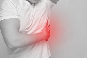 Top Strategies for Managing Intercostal Neuralgia Symptoms