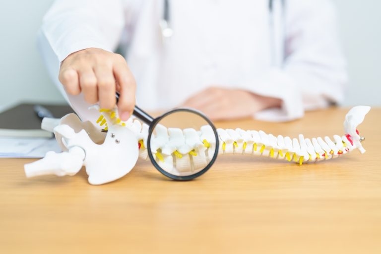How to Alleviate Lower Back Pain After Physical Activity